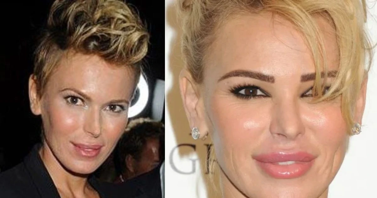 Diana Jenkins Before Plastic Surgery - Truth Explained