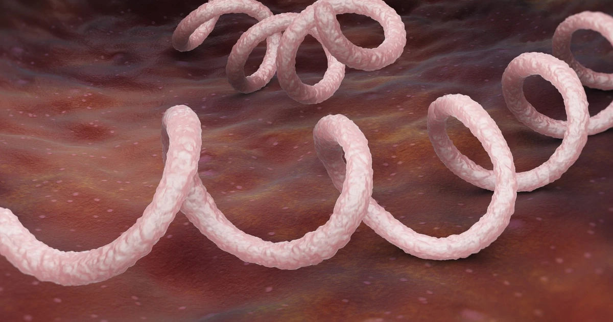 Japan's Annual Syphilis Cases May Exceed 10,000