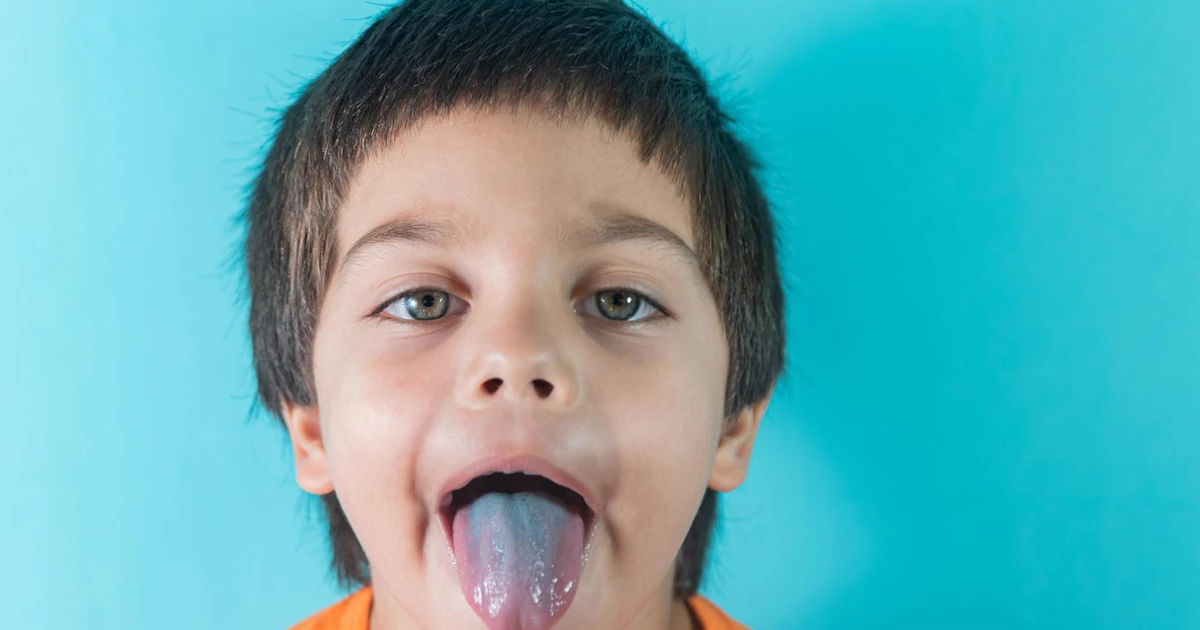Tongue Signs Of Health Problems - What Do Different Tongue Colors Indicate?